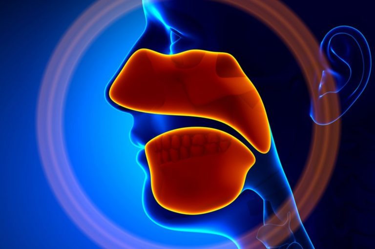 La sinusite odontogena: cos'è e come diagnosticarla - Pretmedica ...